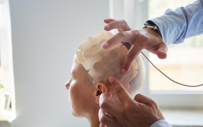 Tumor Treating Fields (TTFields): Die innovative Krebstherapie - Novocure